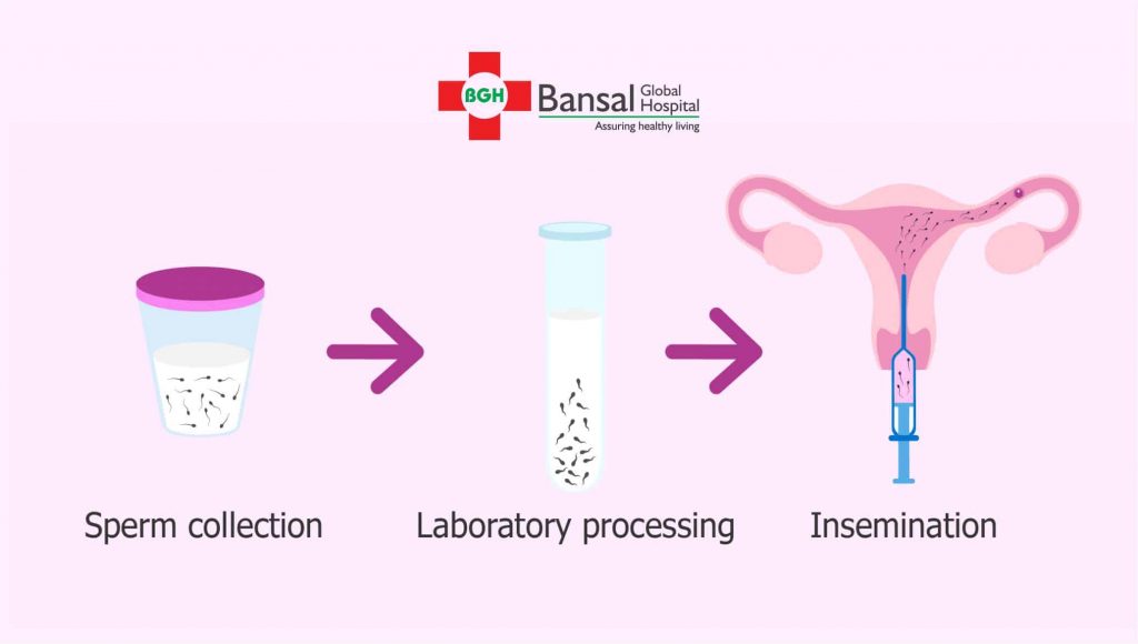 What Is Artificial Insemination Describe This Technique At Robert What Is Artificial Insemination Describe This Technique At Robert