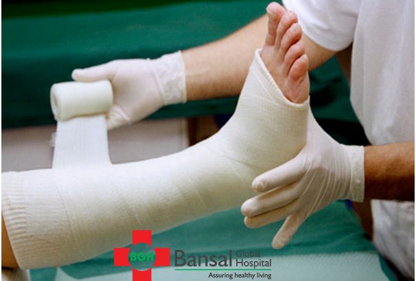 Treatment of fracture without surgery by our expert Dr Suresh Bansal